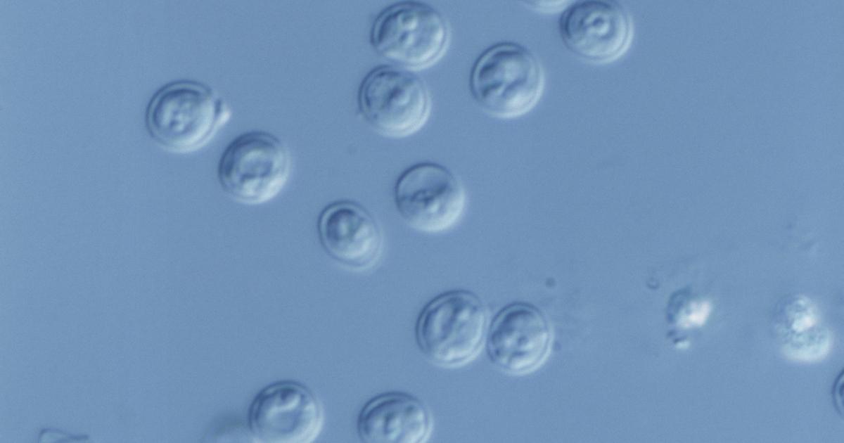 Filtration Process Control for Pathogen Removal and Climate Change ...